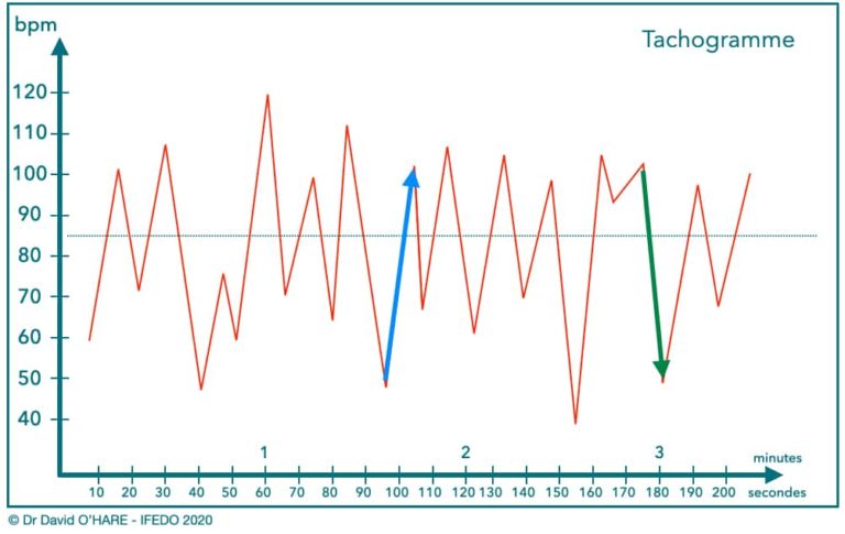 Courbe VFC – 2 – Cohérence Cardiaque Info